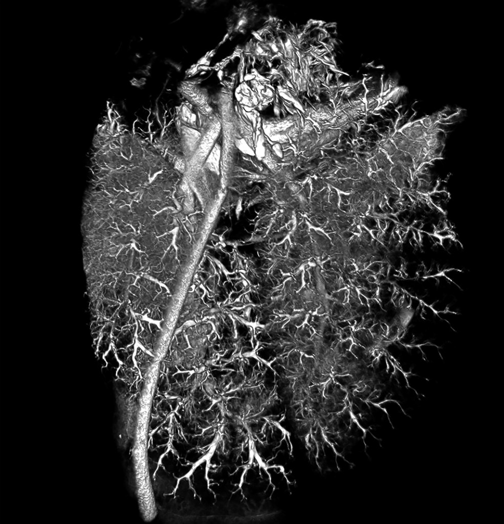 High Contrast Mammal Images Using BriteVu Research Contrast Medium
